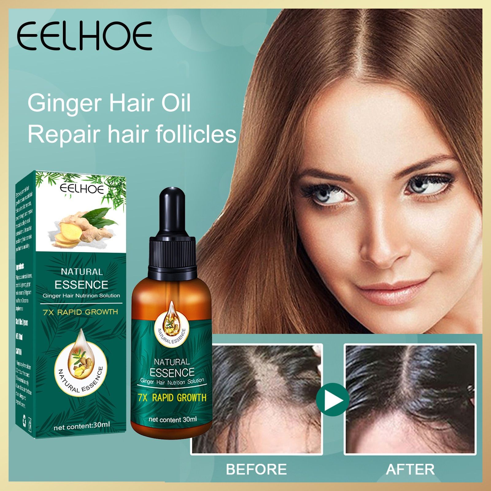 Eelhoe Ginger Hair Follocle Repairing Essential Oil | Eelhoe Official ...