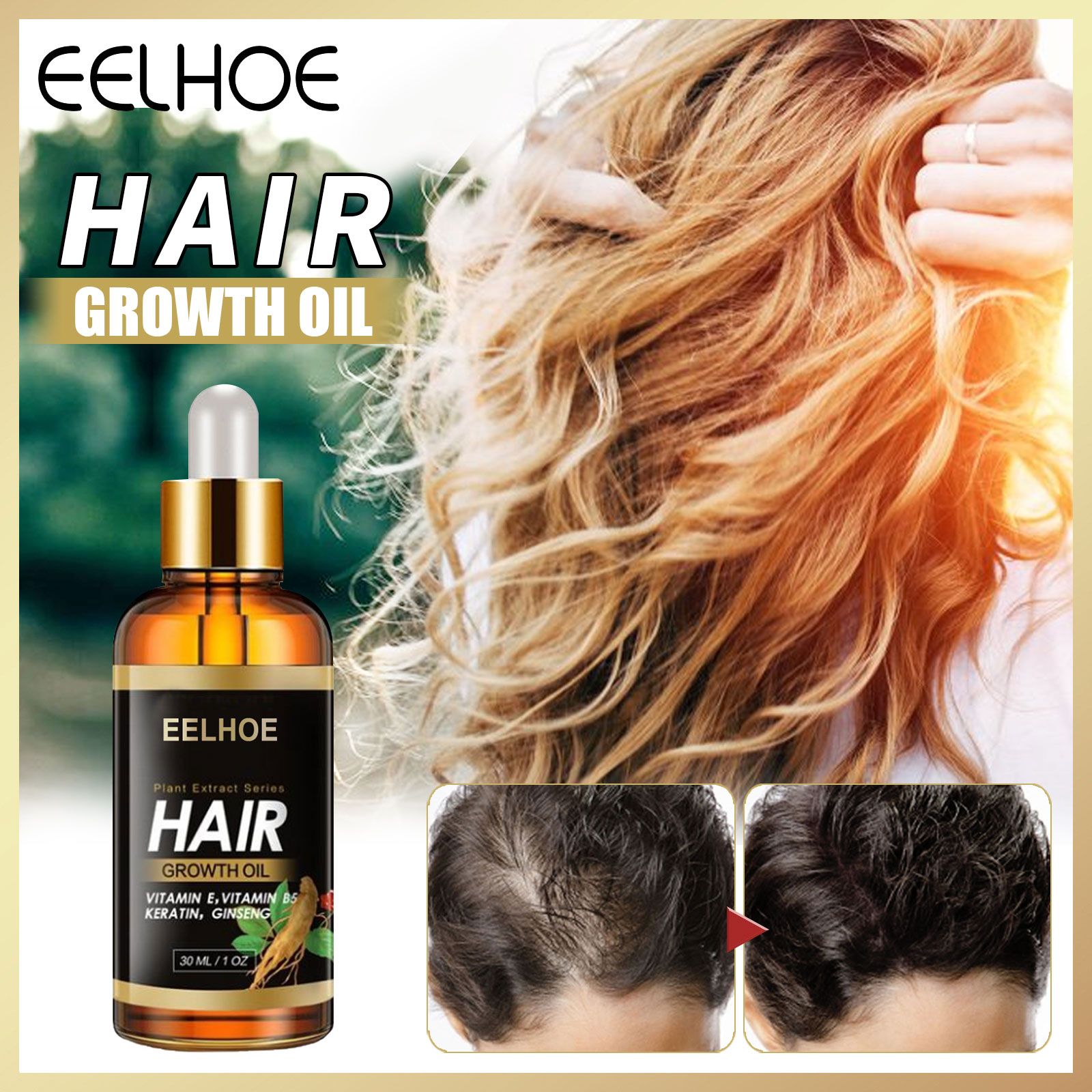 Eelhoe Hair Growth Oil | Eelhoe Official Website